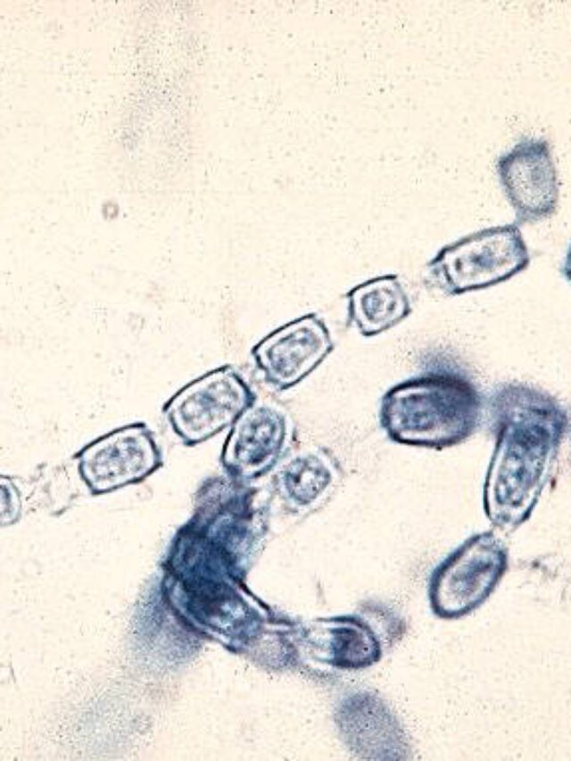 Fungus Among Us: The Unseen Threat of Coccidioides and Valley Fever ...