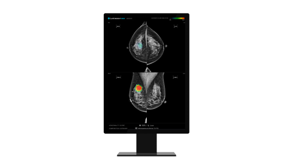 Lunit's AI-Powered Mammography Rivals Radiologists in Breast Cancer Detection - Karmactive