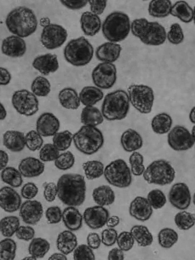 Anthrobots: The Human Cell-Powered Micro-Robots Transforming ...