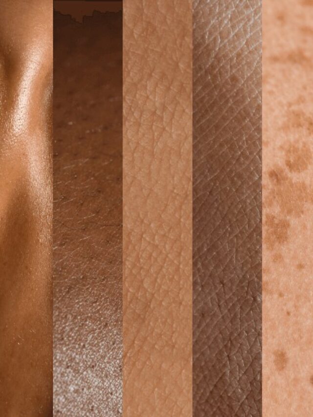 Deadly Skin Disease Now Treatable 100% Patient Recovery - Karmactive