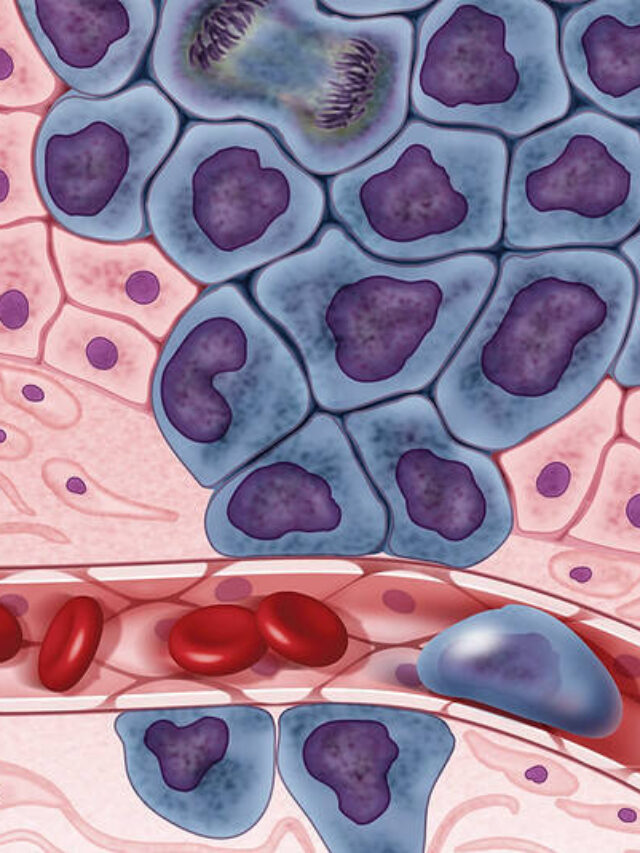 1 in 4 Indians Show Pre-Cancer Signs - Karmactive